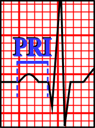 Section 4 : Basic ECG Skills